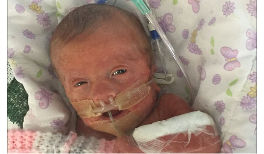 Touching Video Diary Shows How 2-Pound Premature Baby Fought for Her ...